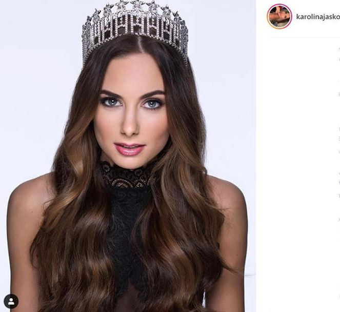 Şans eseri öğrenmişti! Ünlü model Karolina Jasko kanseri yendi ...